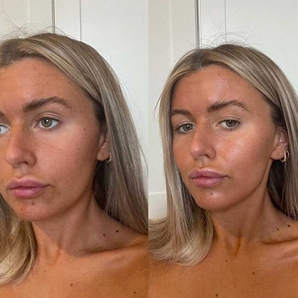 Gradual Self Tanner How To Tips For Best Results | Tanologist